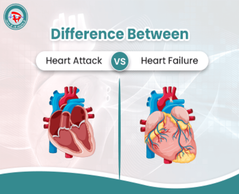 Difference Between Heart Attack and Heart Failure Difference Between Heart Attack and Heart Failure